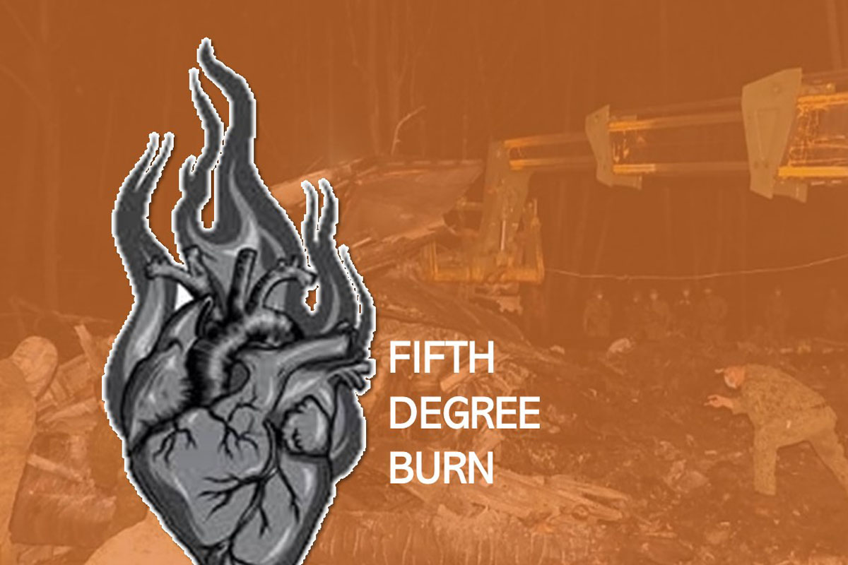 FIFTH-DEGREE BURN - The POST